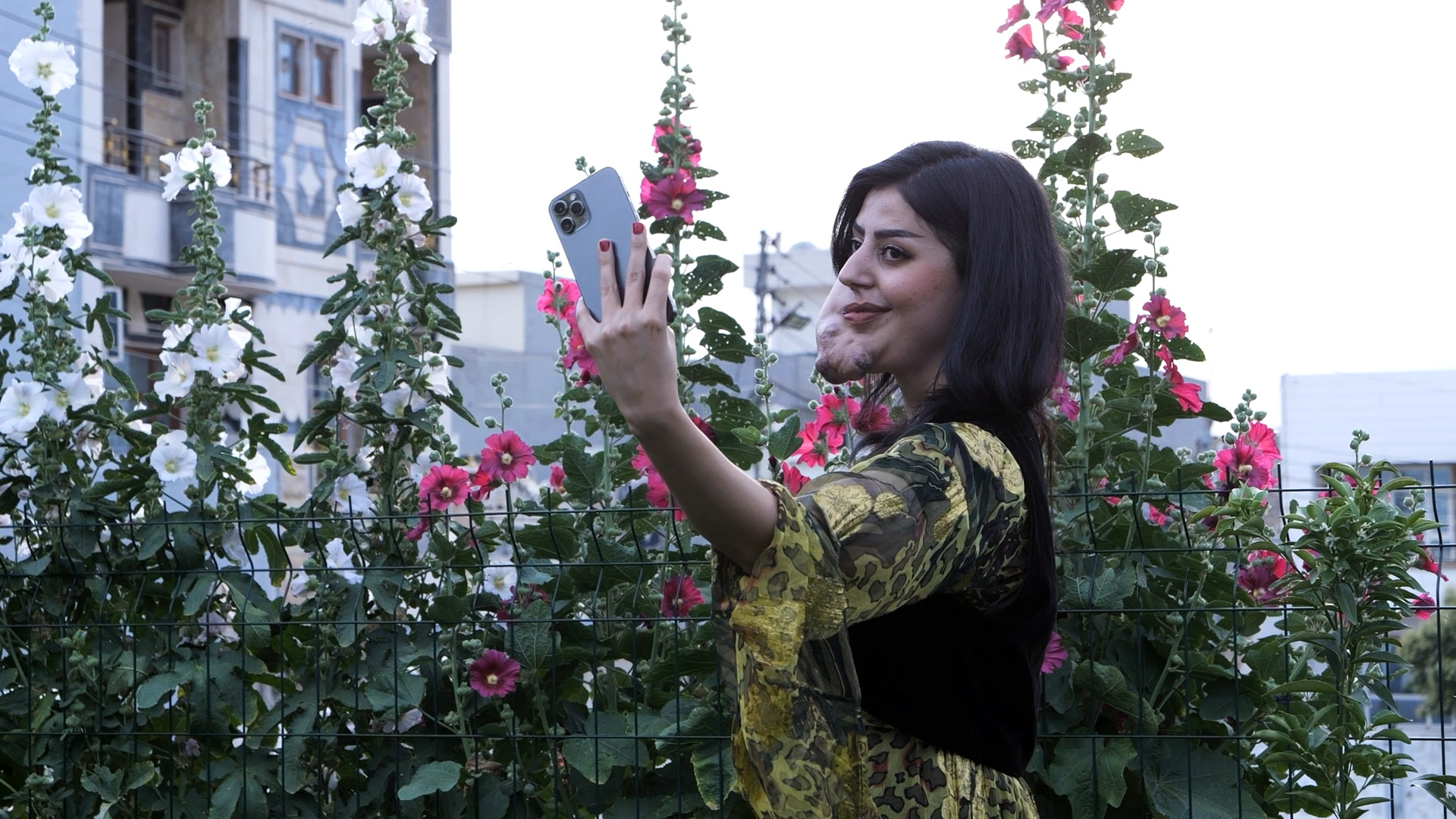 نەخۆشییەکەی نەبووە رێگر لە بەدیهێنانی خەونەکەی - AVA News